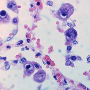 FL1953 - Protomyxzoa rheumatica - Funneliformis mosseae Version 1.5 ...