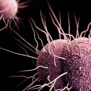 FL1953 - Protomyxzoa rheumatica - Funneliformis mosseae Version 1.5 ...